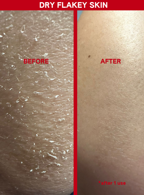 SOFT-TOUCH: PRE-SHOWER EXFOLIATING BODY MASK AHA 30% + BHA 2%